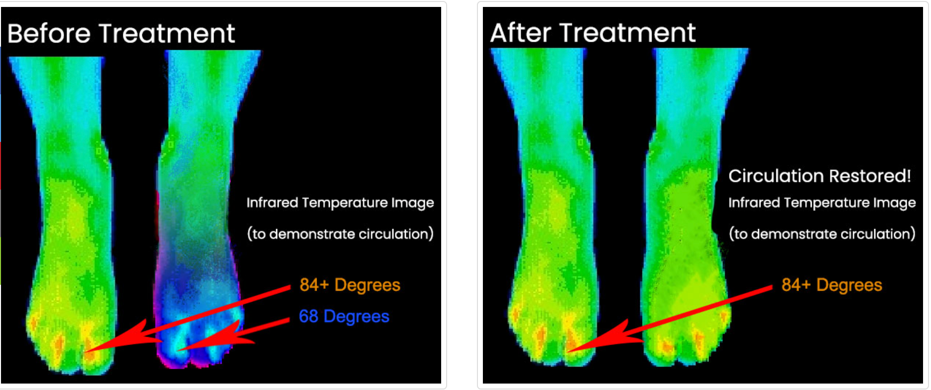 ReBuilder® 300 Nerve Pain Eliminator | Shop ChiroThin